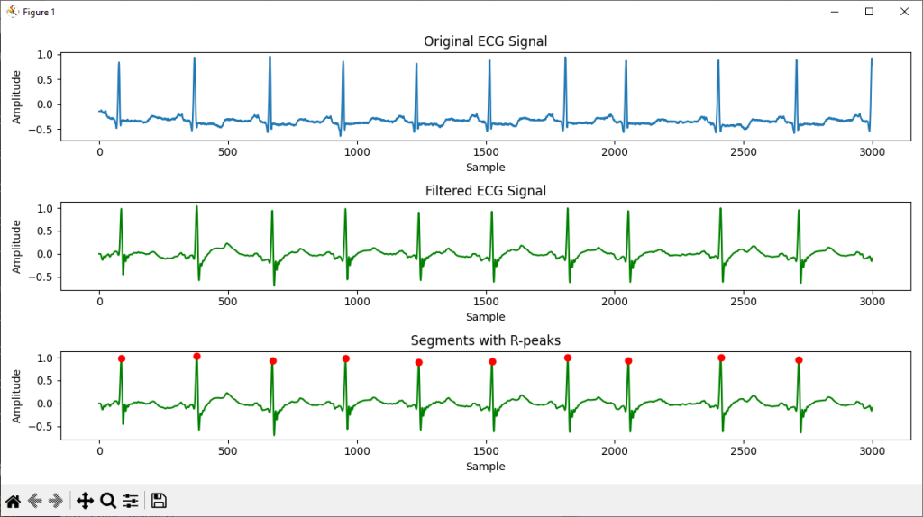 ECG R peaks detection with Python | FYP Solutions
