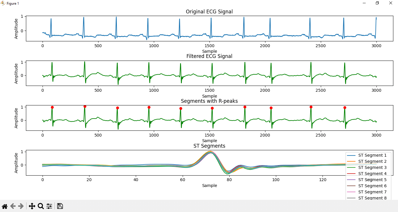 st_segment | FYP Solutions
